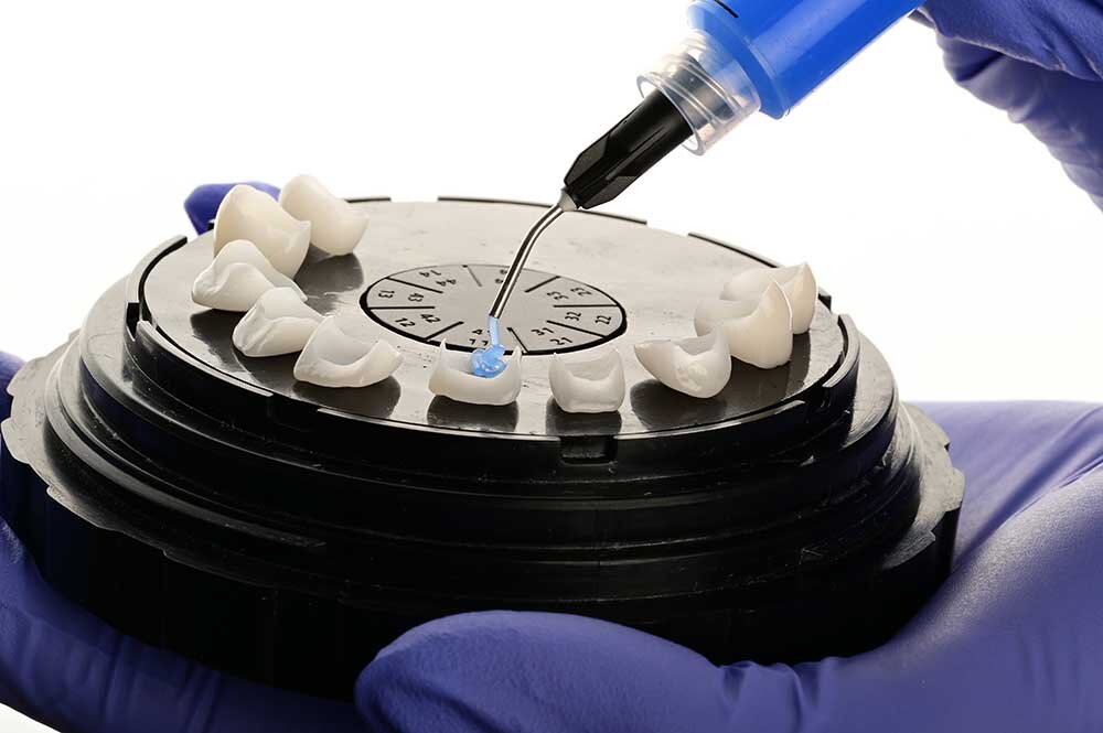 Porcelain Veneers Beverly Hills | Veneers West Hollywood | Dr. Borzoo