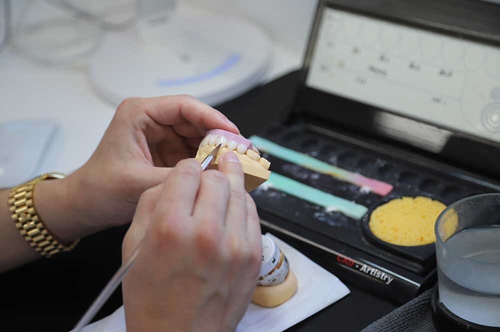 Porcelain Veneers Beverly Hills | Veneers West Hollywood | Dr. Borzoo